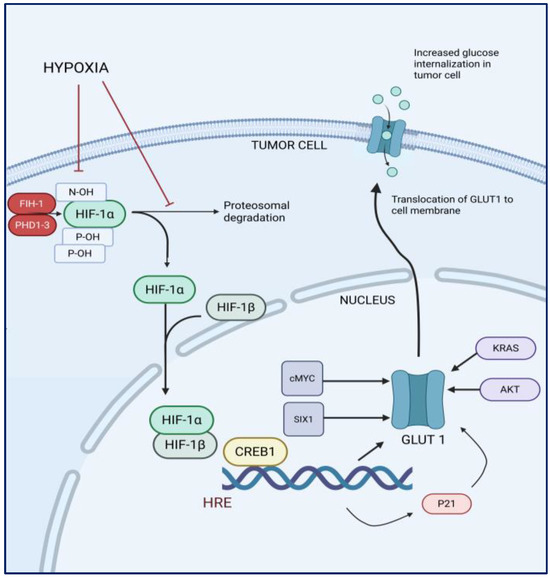 GLUT1 as a Potential Therapeutic Target in Glioblastoma