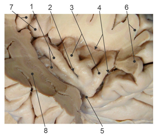 Insular Cortex—Biology and Its Role in Psychiatric Disorders: A Narrative Review