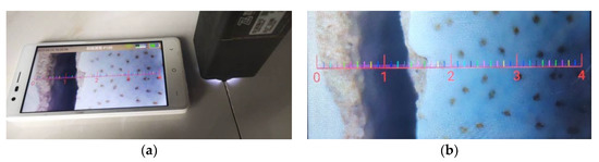 An FPGA-Based Laser Virtual Scale Method for Structural Crack Measurement