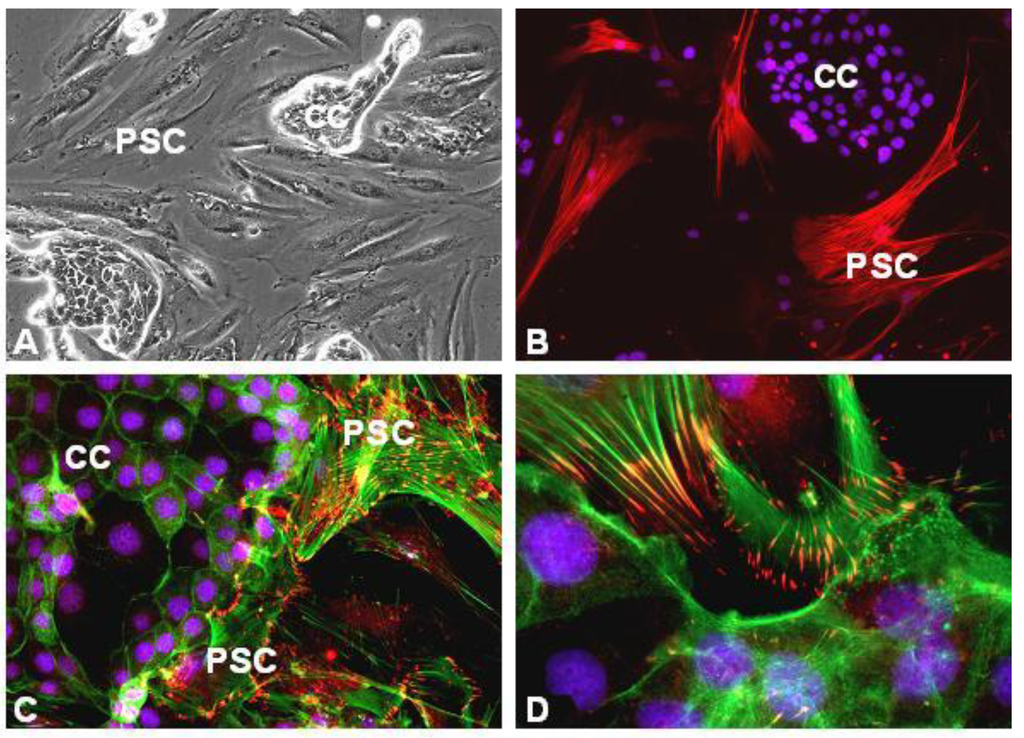 Interaction of Stellate Cells with Pancreatic Carcinoma Cells