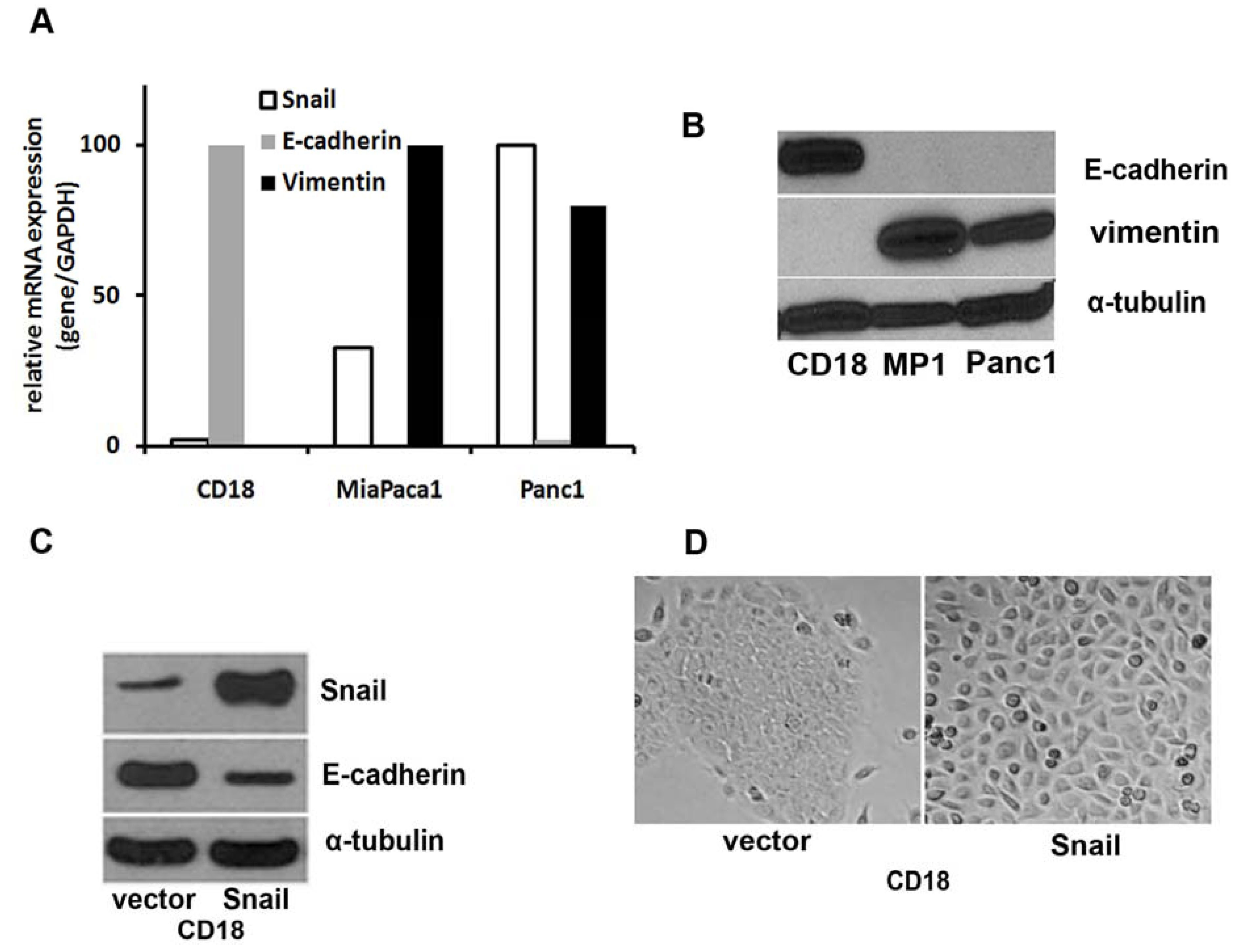 Cancers | Free Full-Text | Contribution of Epithelial-Mesenchymal ...