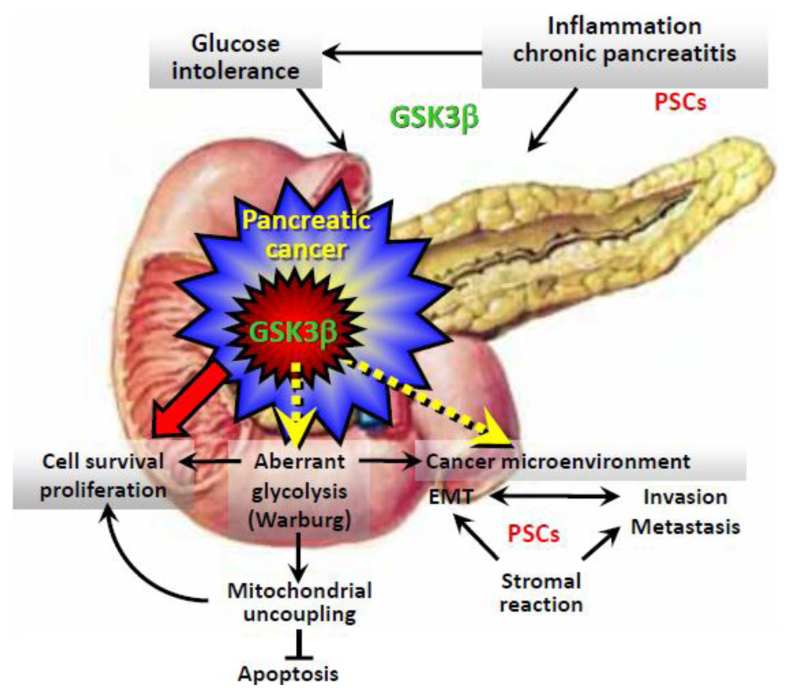 Cancers Free Full Text Metabolic Disorder Inflammation And