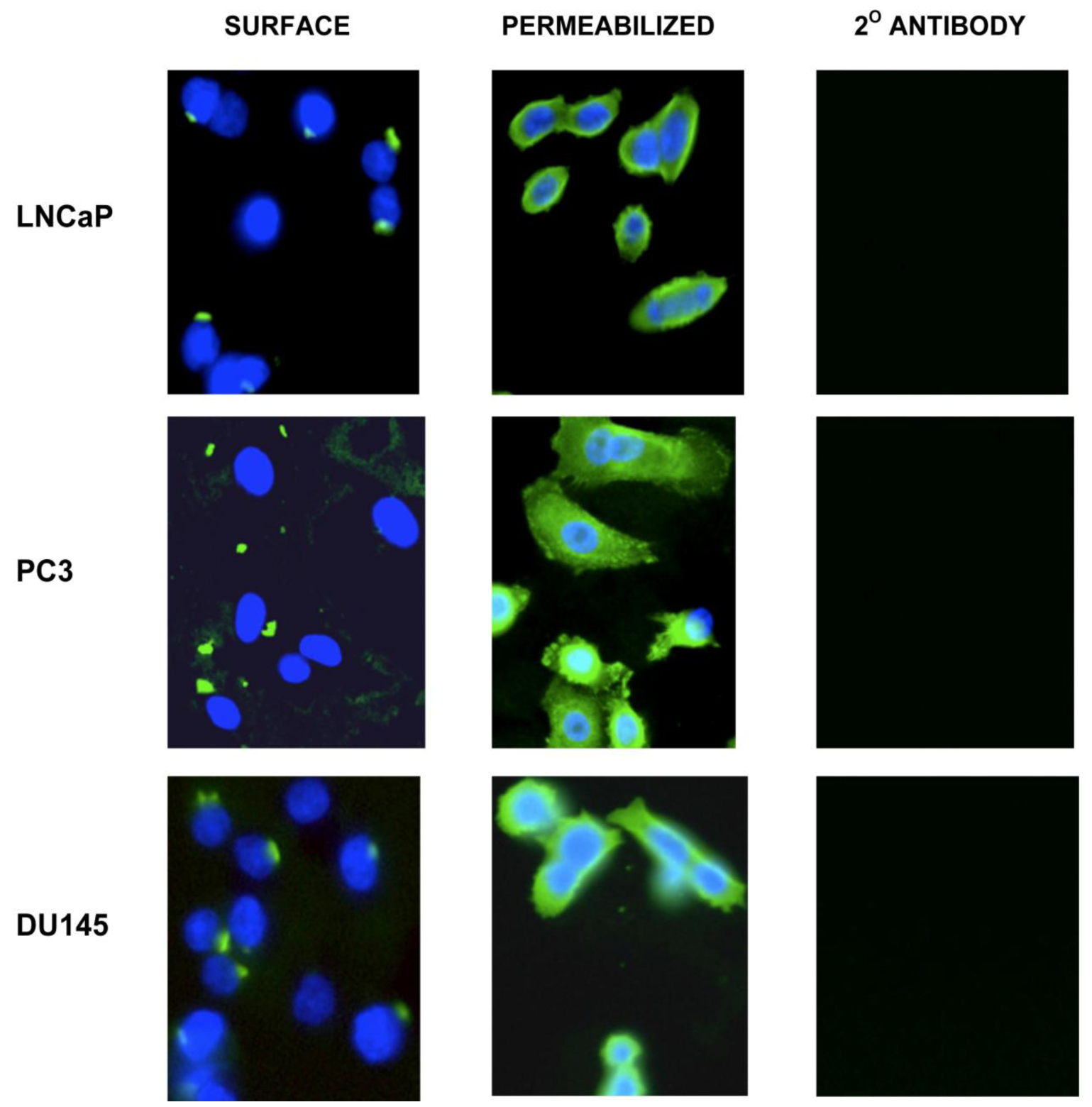 Two Domains of Vimentin Are Expressed on the Surface of Lymph Node ...