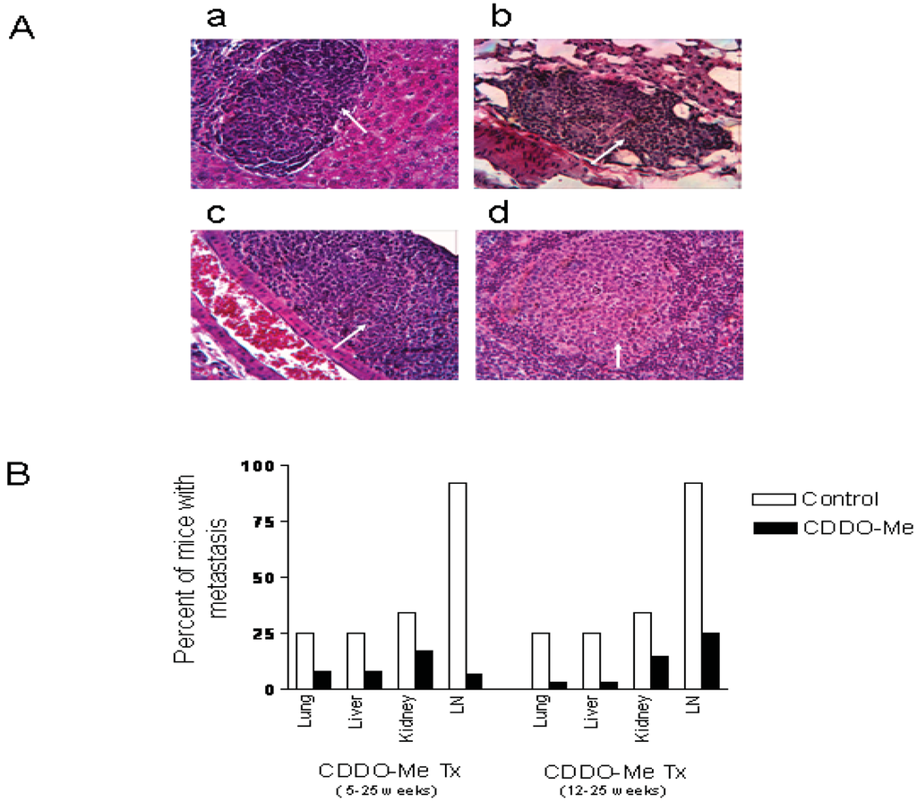 Prevention of Prostate Cancer with Oleanane Synthetic Triterpenoid CDDO ...