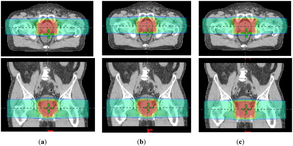 Reducing the Cost of Proton Radiation Therapy: The Feasibility of a ...