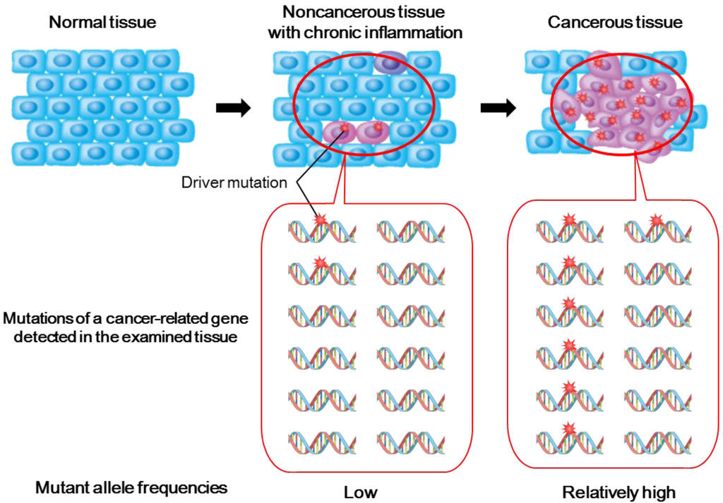 Cancers | Special Issue : Next Generation Sequencing Approaches in Cancer
