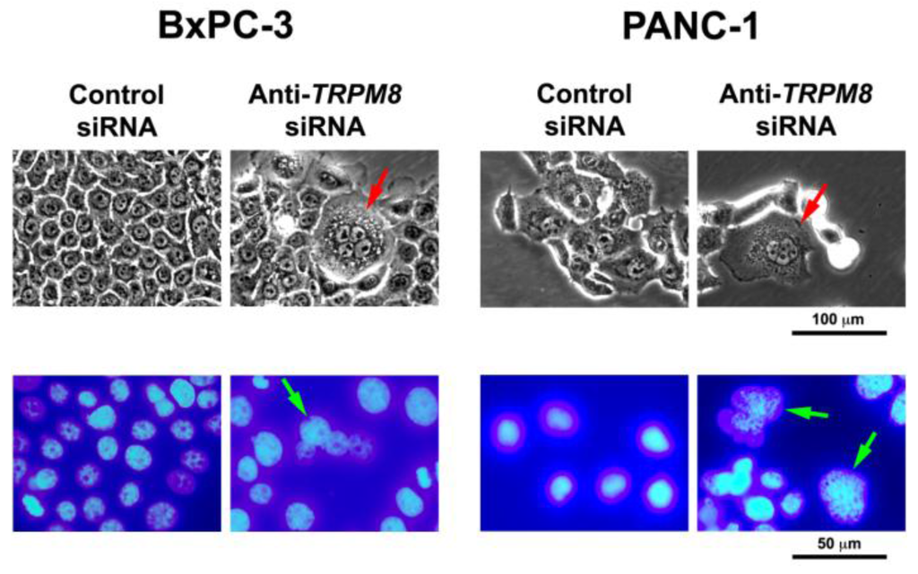 Cancers | Special Issue : Cancer Cell Proliferation