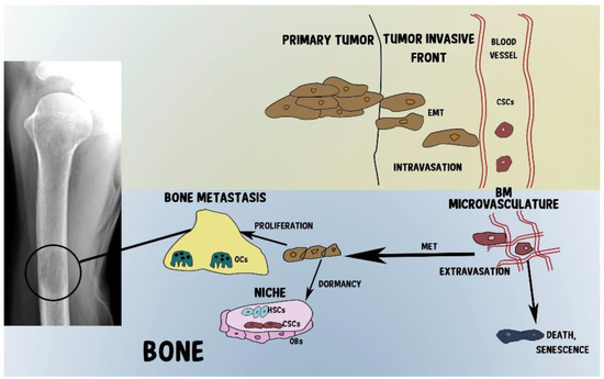 Cancer Stem Cells, Bone and Tumor Microenvironment: Key Players in Bone ...