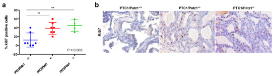 Loss of One or Two PATZ1 Alleles Has a Critical Role in the Progression ...