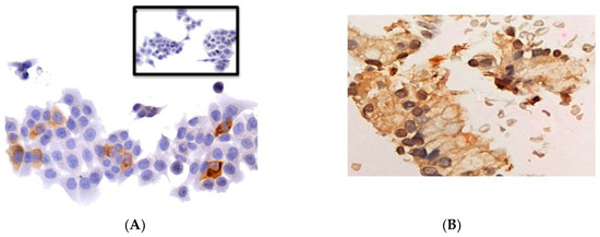 A Phase II Study of Pelareorep (REOLYSIN®) in Combination with ...