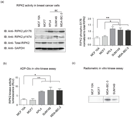 RIPK2: New Elements in Modulating Inflammatory Breast Cancer Pathogenesis