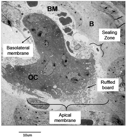 The Osteoclast in Bone Metastasis: Player and Target