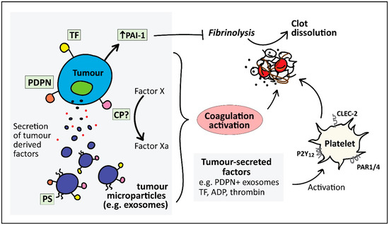 Cancers | Special Issue : The Role of Thrombosis and Haemostasis in Cancer