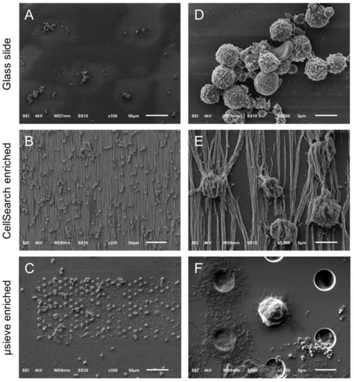 Scanning Electron Microscopy of Circulating Tumor Cells and Tumor ...
