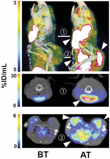 Emerging Functional Imaging Biomarkers of Tumour Responses to Radiotherapy