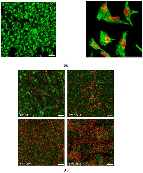 Proteomic Analysis Implicates Vimentin in Glioblastoma Cell Migration