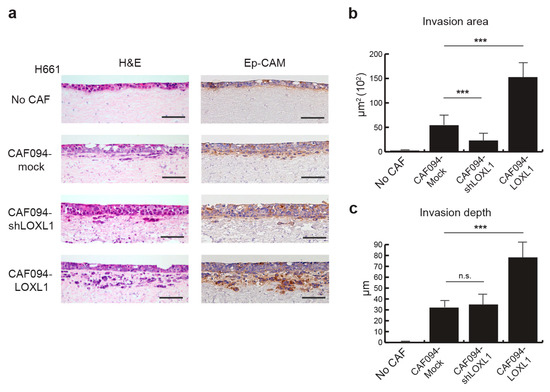 LOXL1 Is Regulated by Integrin α11 and Promotes Non-Small Cell Lung ...