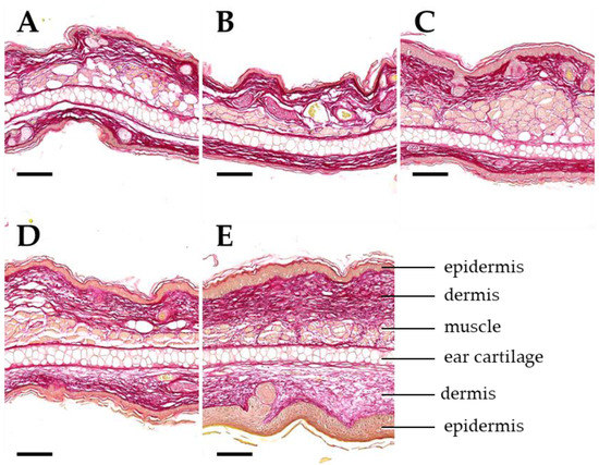 Acute Skin Damage and Late Radiation-Induced Fibrosis and Inflammation ...