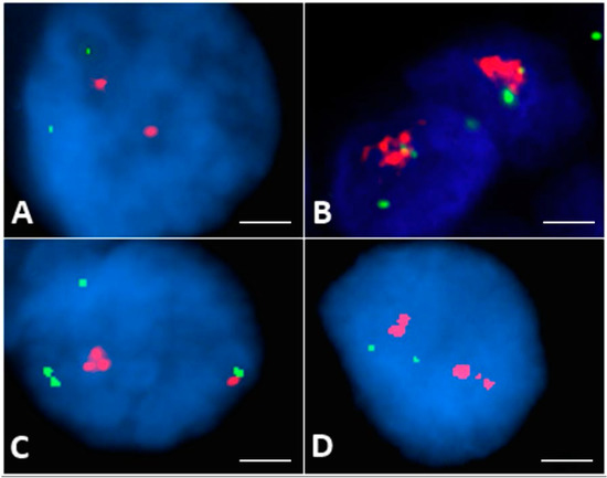 Cancers Free Full Text Axl Is A Novel Predictive Factor And