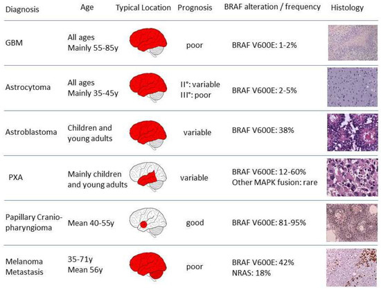 Oncogenic BRAF Alterations and Their Role in Brain Tumors
