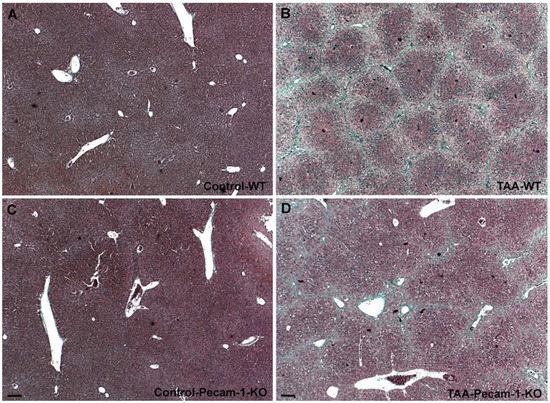 Development of A New Mouse Model for Intrahepatic Cholangiocellular ...