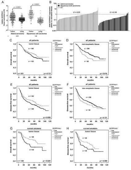 Cancers | Free Full-Text | Clinical Significance of SERPINA1 Gene and ...