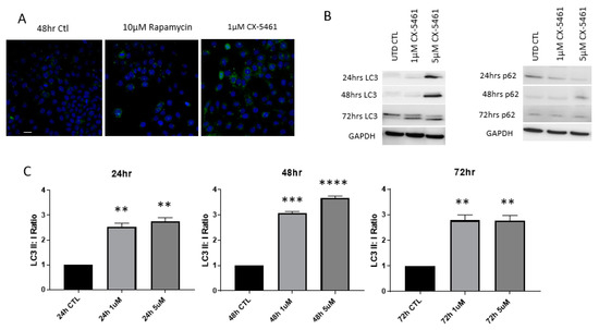 The Targeting of RNA Polymerase I Transcription Using CX-5461 in ...