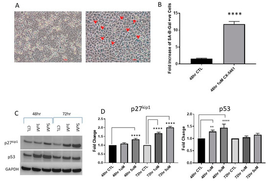 The Targeting of RNA Polymerase I Transcription Using CX-5461 in ...