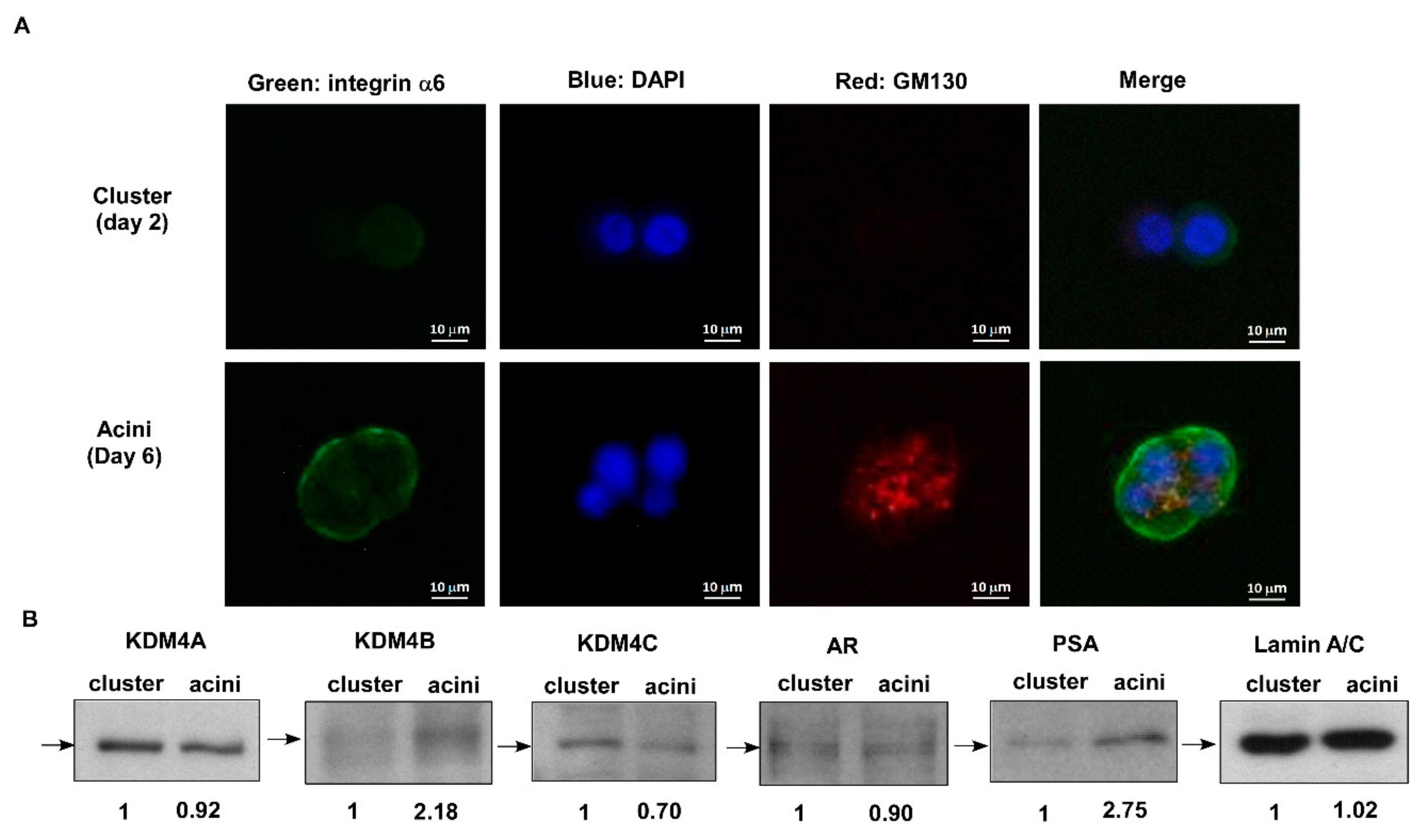 Histone Demethylase KDM4C Stimulates the Proliferation of Prostate ...