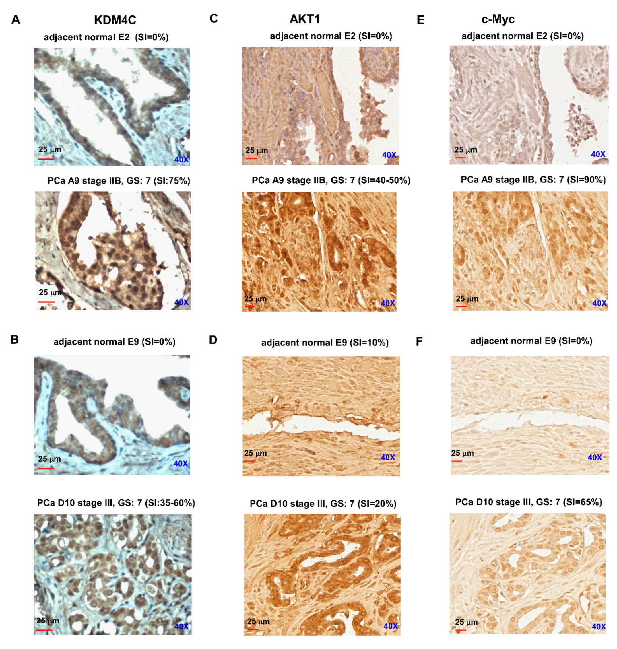 Histone Demethylase KDM4C Stimulates the Proliferation of Prostate ...