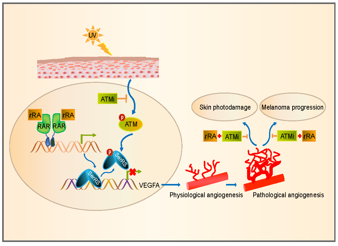 Cancers | Free Full-Text | Targeting Angiogenesis by Blocking the ATM ...