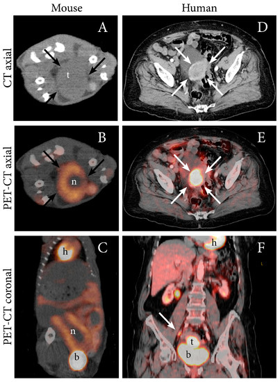 Imaging of Preclinical Endometrial Cancer Models for Monitoring Tumor ...