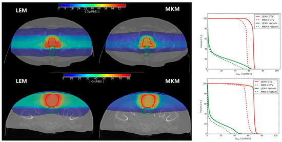 Rectum Dose Constraints for Carbon Ion Therapy: Relative Biological ...