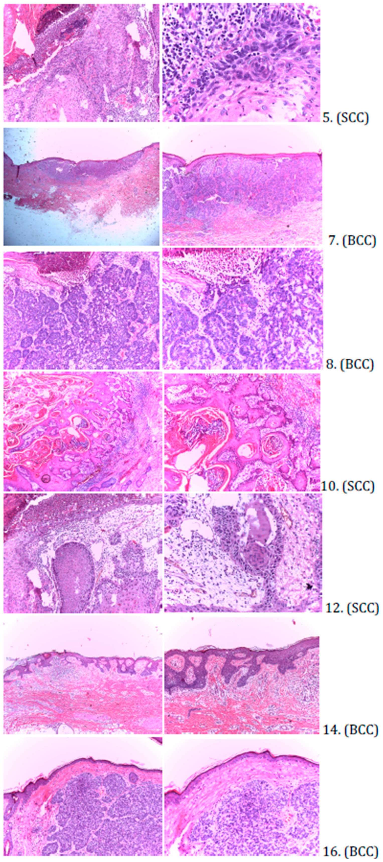Cancers | Free Full-Text | Protein Oxidative Damage in UV-Related Skin ...