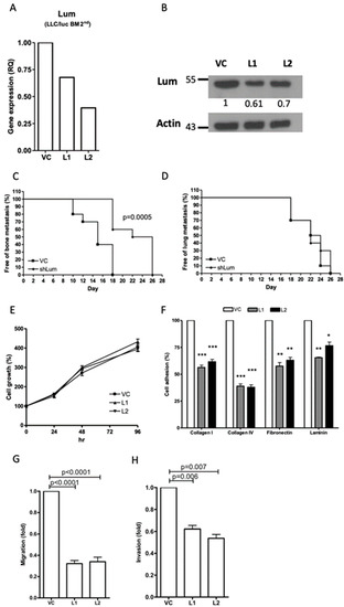 Elevated Expression of Lumican in Lung Cancer Cells Promotes Bone ...