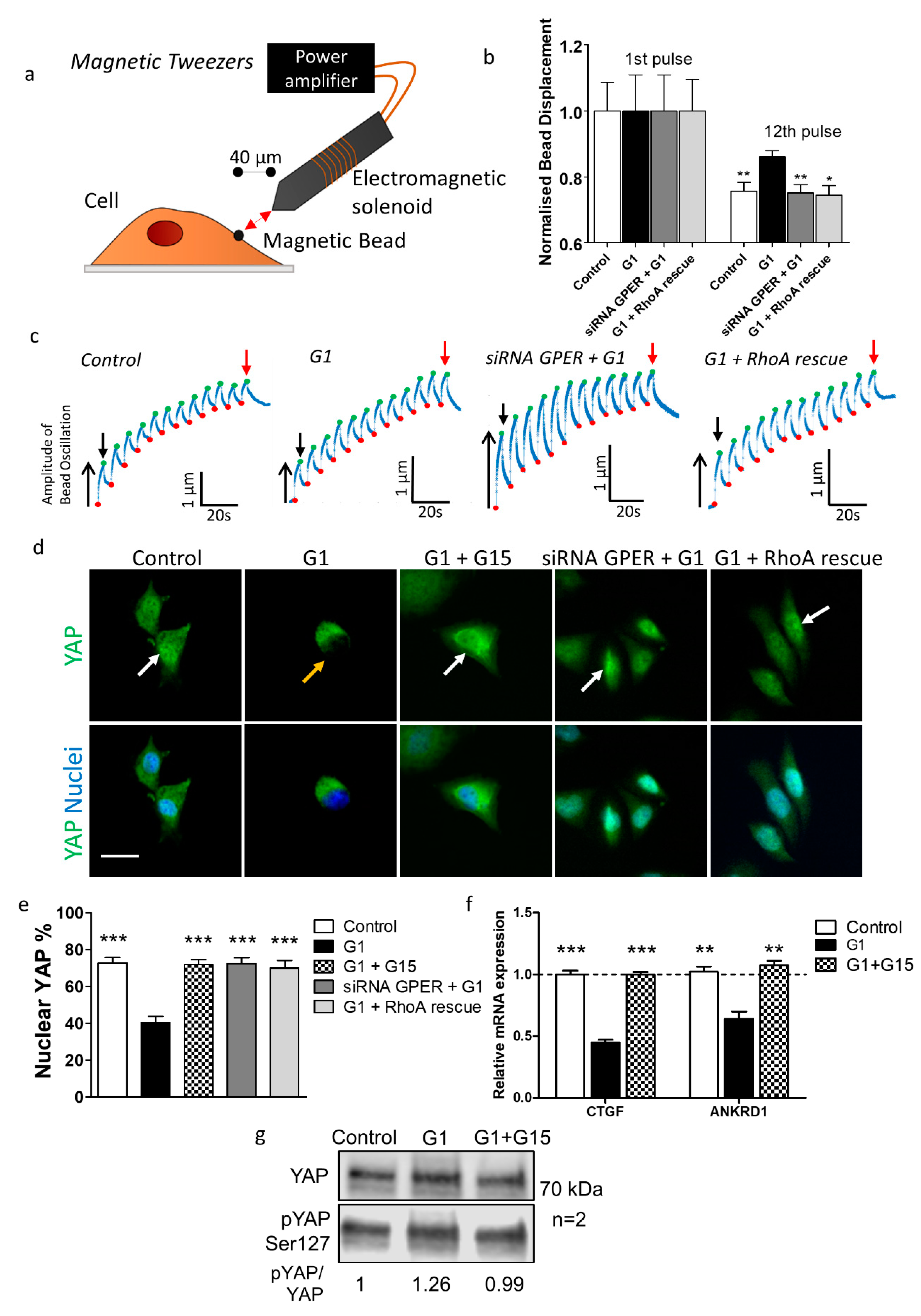 GPER Activation Inhibits Cancer Cell Mechanotransduction and Basement ...