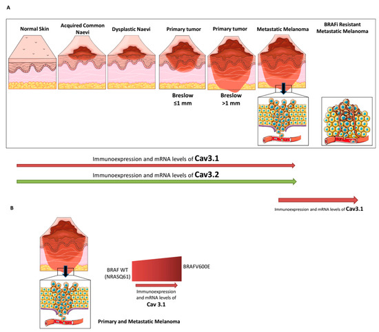 T-Type Calcium Channels: A Potential Novel Target in Melanoma