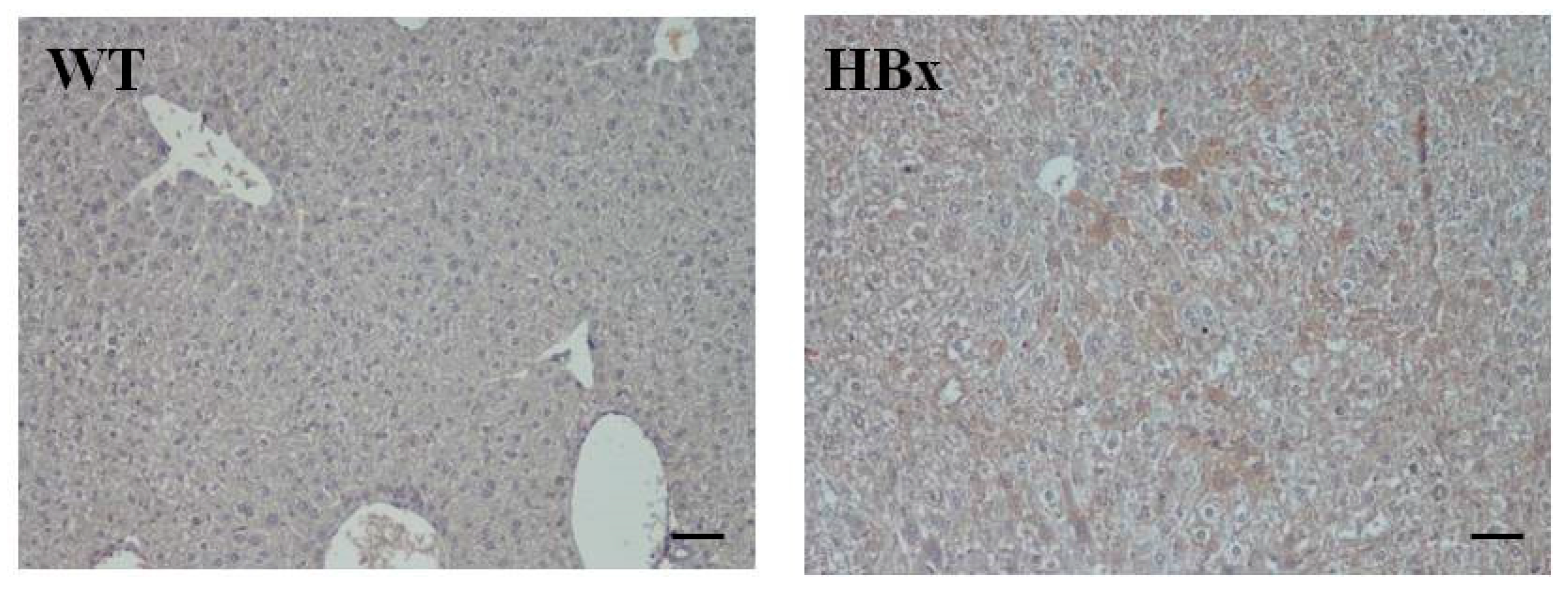 Utilizing Experimental Mouse Model to Identify Effectors of ...