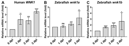 WNK1 Kinase Stimulates Angiogenesis to Promote Tumor Growth and Metastasis