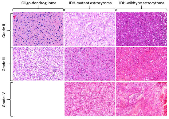 Glioma Grading via Analysis of Digital Pathology Images Using Machine Learning