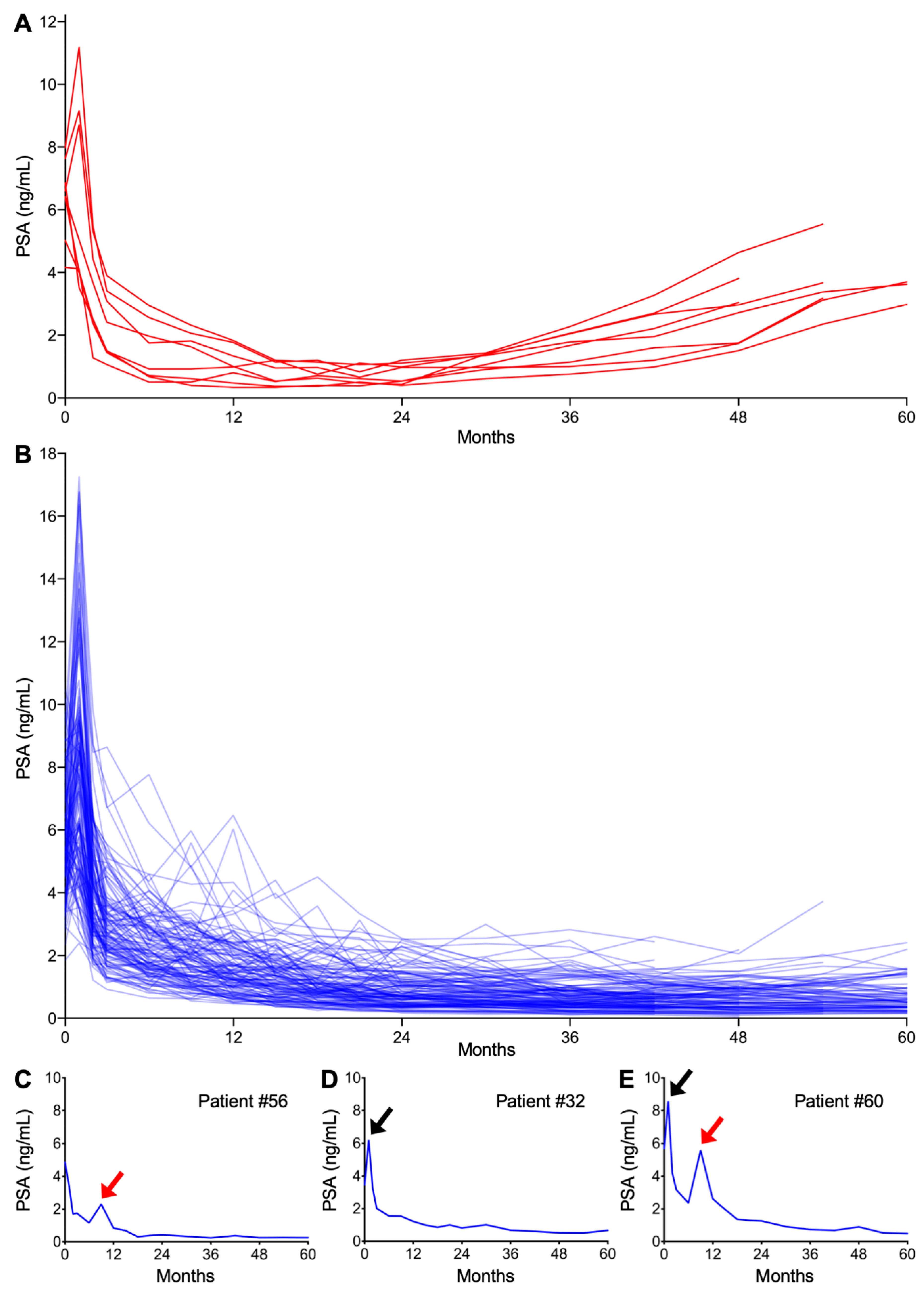 Kinetics of Prostate-Specific Antigen after Carbon Ion Radiotherapy for ...