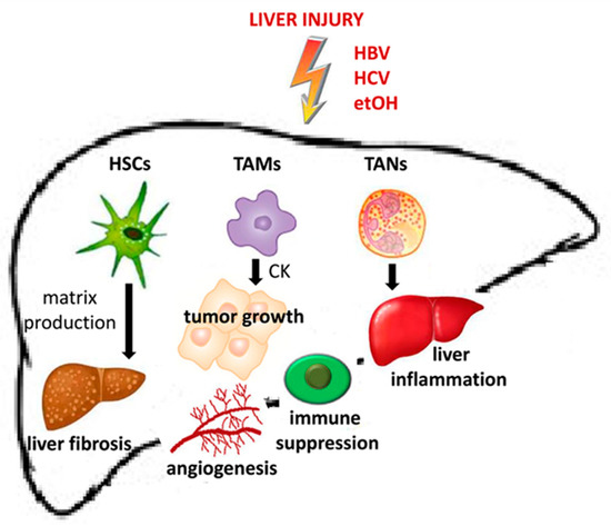 Inflammatory Mechanisms of HCC Development