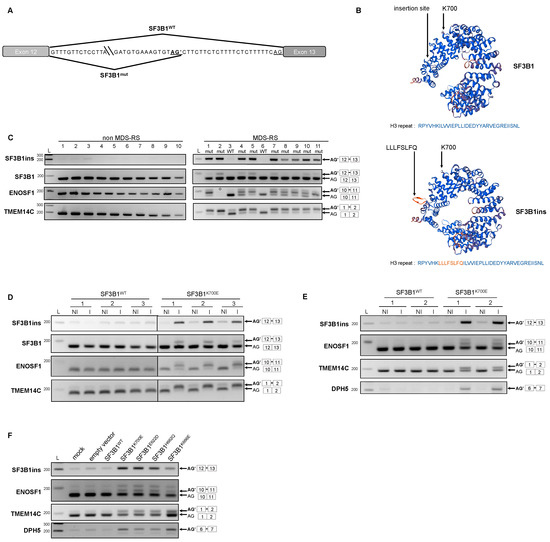 Human Cancer-Associated Mutations of SF3B1 Lead to a Splicing ...