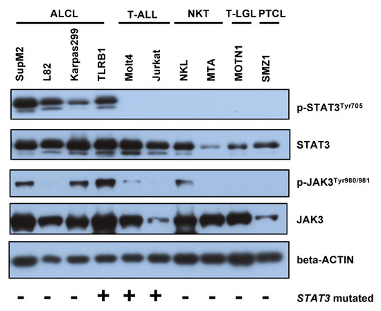 STAT3 Mutation Is Associated with STAT3 Activation in CD30+ ALK− ALCL