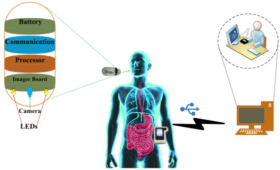A Fluorescence-Based Wireless Capsule Endoscopy System for Detecting Colorectal Cancer