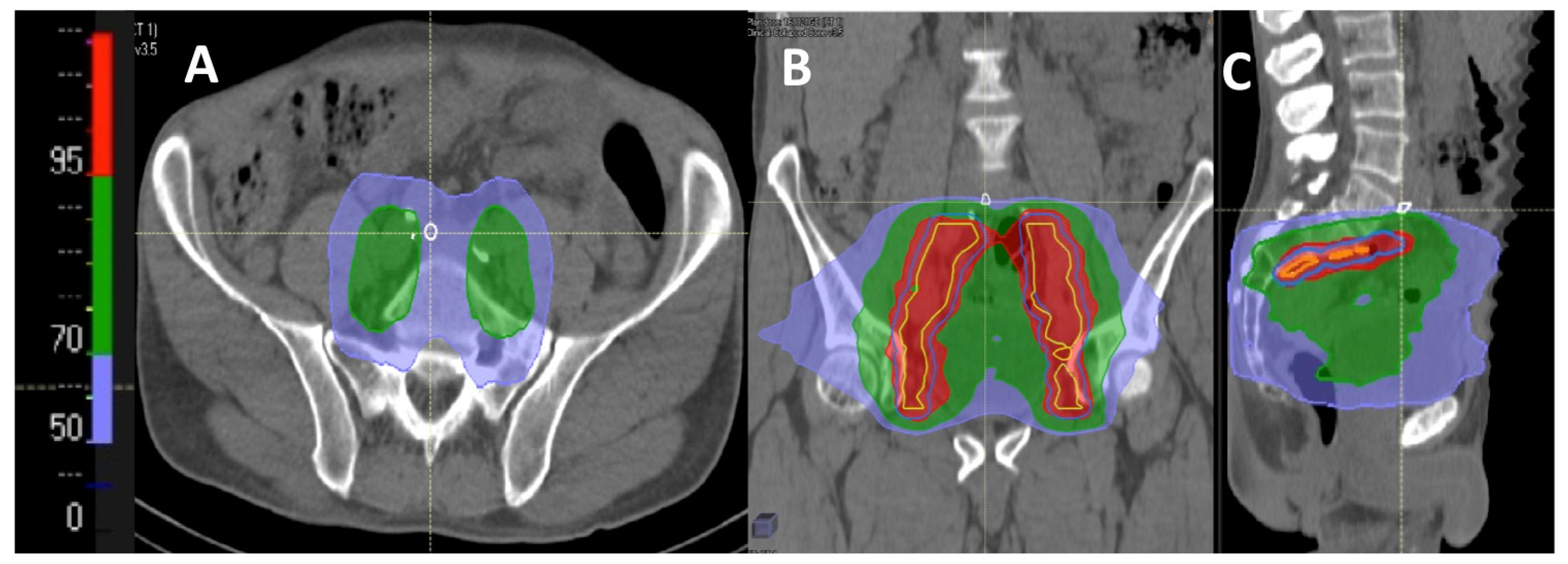 Cancers | Free Full-Text | Haute Couture or Ready-To-Wear? Tailored ...