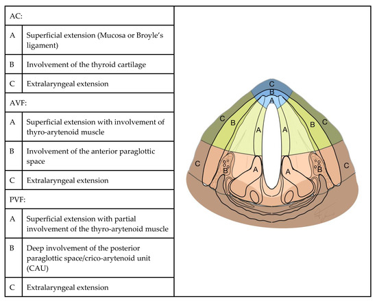 Imaging Accuracy in Preoperative Staging of T3-T4 Laryngeal Cancers