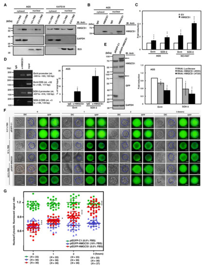 Mevalonate Pathway Enzyme HMGCS1 Contributes to Gastric Cancer Progression
