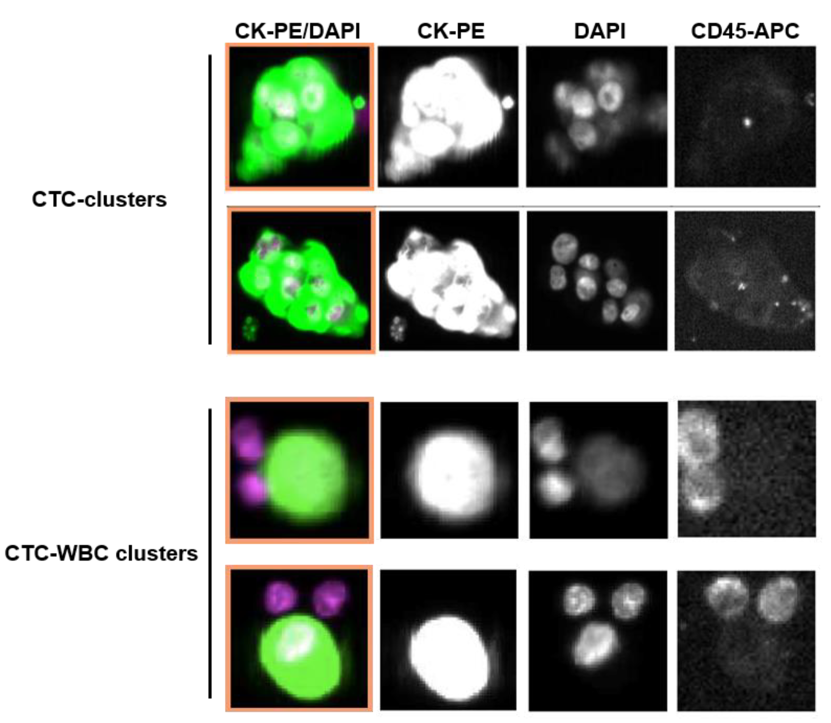 Analysis of a Real-World Cohort of Metastatic Breast Cancer Patients ...