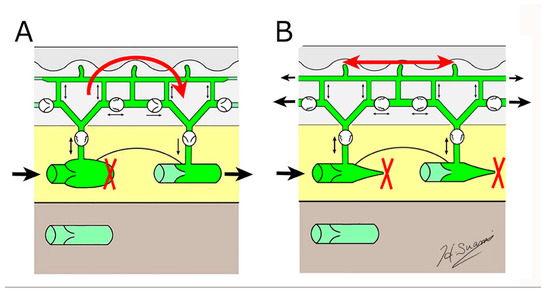 Anatomical Theories of the Pathophysiology of Cancer-Related Lymphoedema